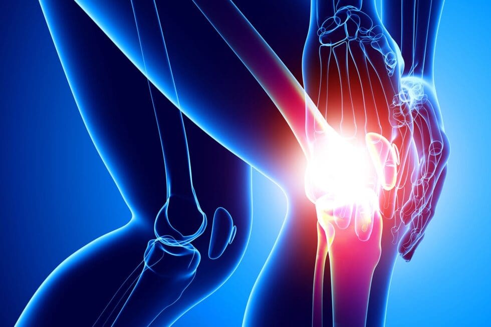 Arthroscopic Meniscus Repair | Orthopaedic Specialists of Connecticut